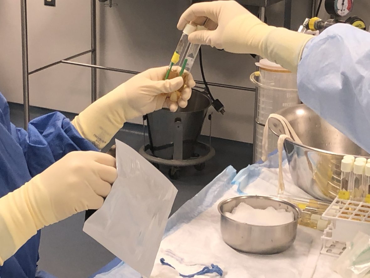 One person dies, another lives | CBC News