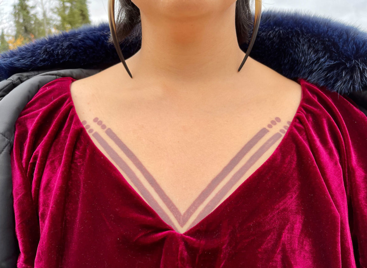 Etched on the skin | CBC News