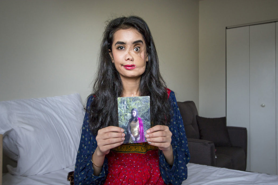 The face of bravery | CBC News