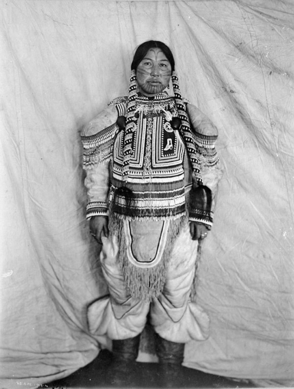 Etched on the skin | CBC News