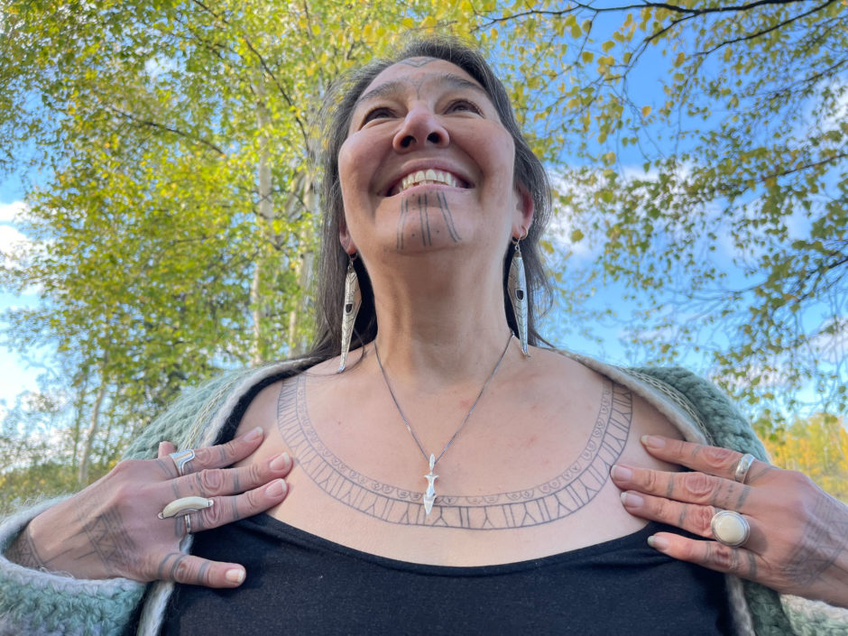 Etched on the skin | CBC News