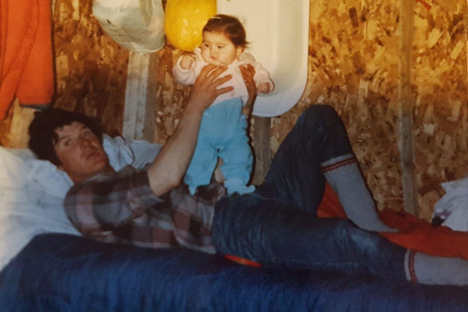 Life over limb | CBC News