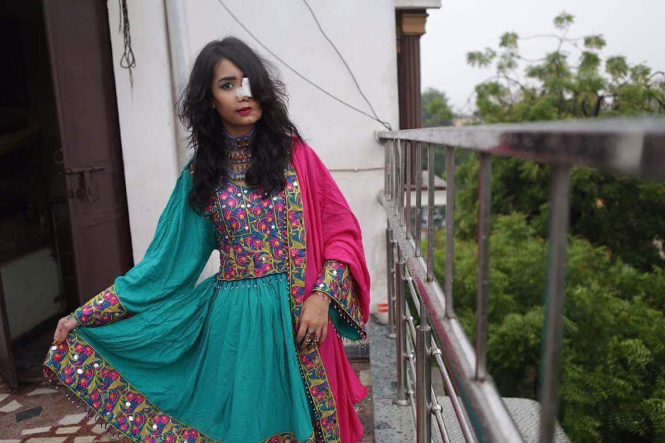 The face of bravery | CBC News