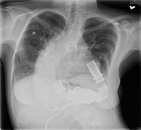 Young at heart | CBC News