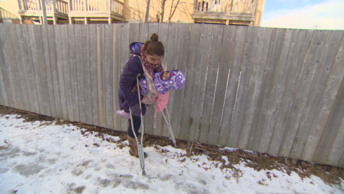 Life over limb | CBC News